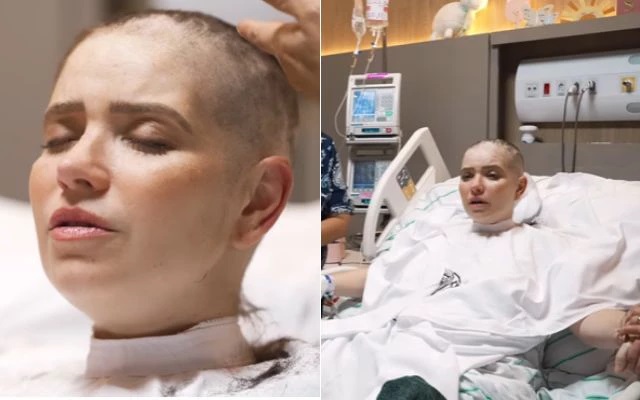 Com câncer avançado, Camila Campos raspa os cabelos – Correio